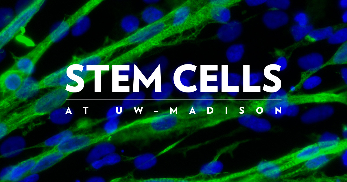 Stem Cells – UW–Madison News