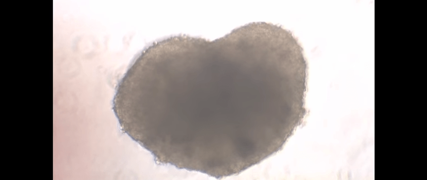 Stem cell ‘heart patch’ moves closer to clinic – UW–Madison News