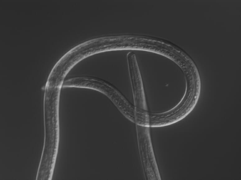 Parasitic worms use their keen senses to wriggle through their hosts ...