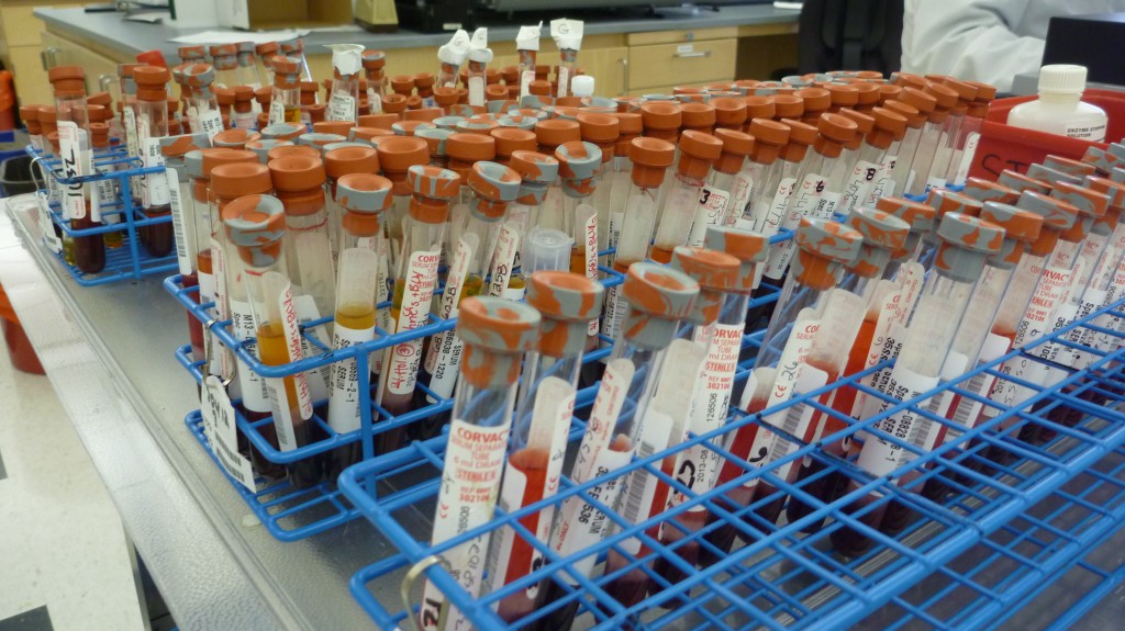 UW–Madison works to protect Wisconsin poultry from avian flu – UW ...