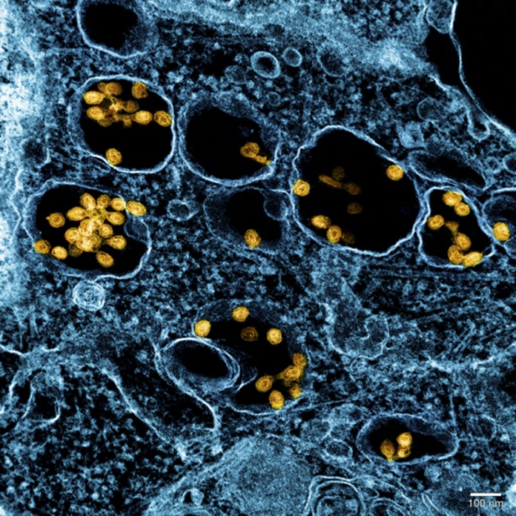 Wild primate virus has pandemic potential should it jump the species ...