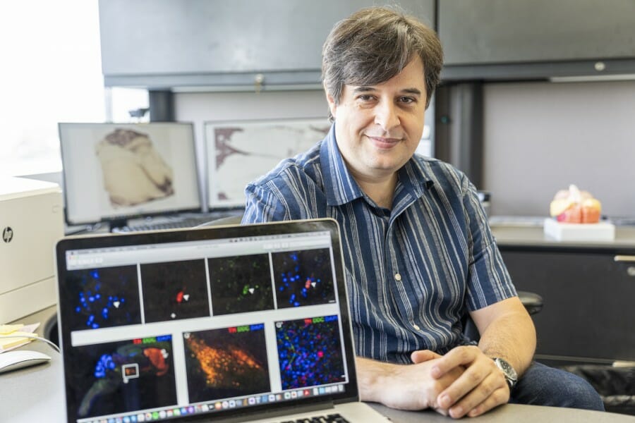 Study shows differences between brains of primates — humans, other apes ...