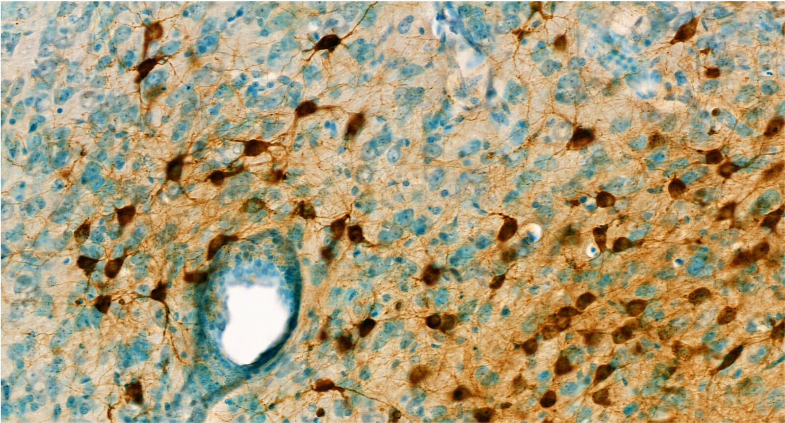 Brain-penetrating drug candidate effective against deadly encephalitis ...