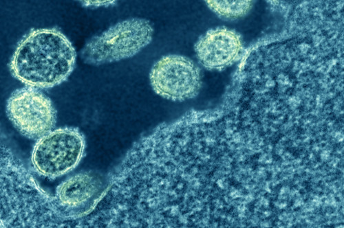 UW–Madison researchers reveal how key protein might help influenza A ...