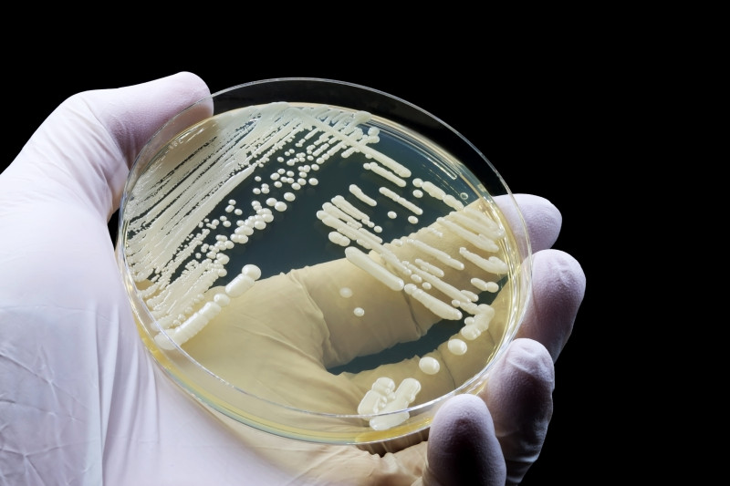 UW–Madison researchers identify therapeutic target for dangerous fungal ...